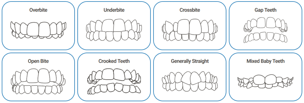 Invisalign® Quiz - Dental Depot
